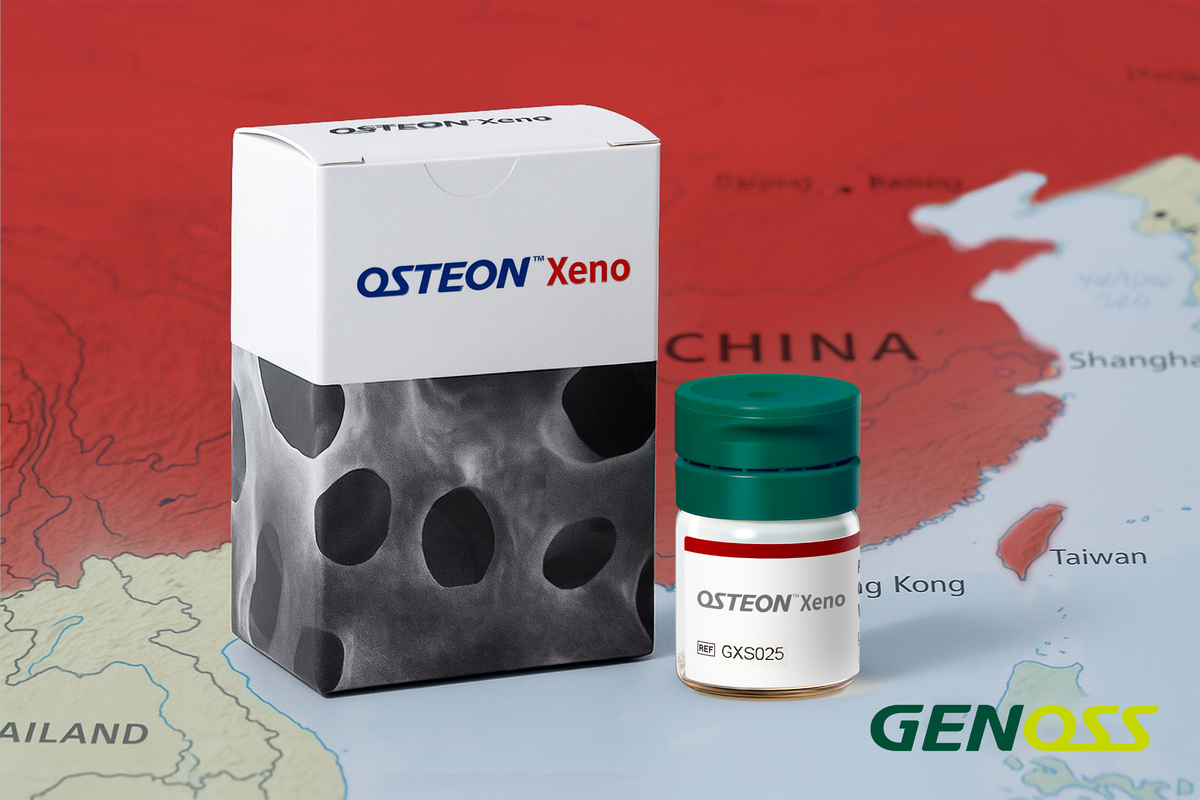 제노스, 이종골 이식재 ‘OSTEON Xeno’ 중국 의료기기 허가 획득… 이종골 시장 진출 본격화 - 세계일보